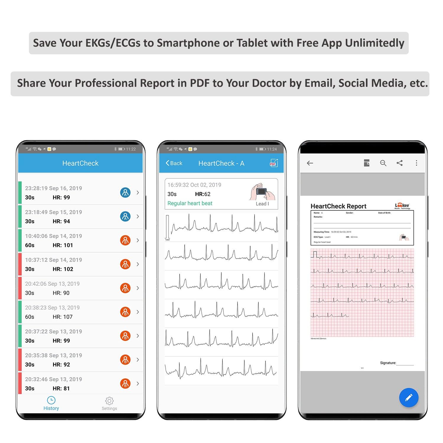 LOOKEE® Personal ECG / EKG Heart Monitor | Color Touch Screen | Cable ...